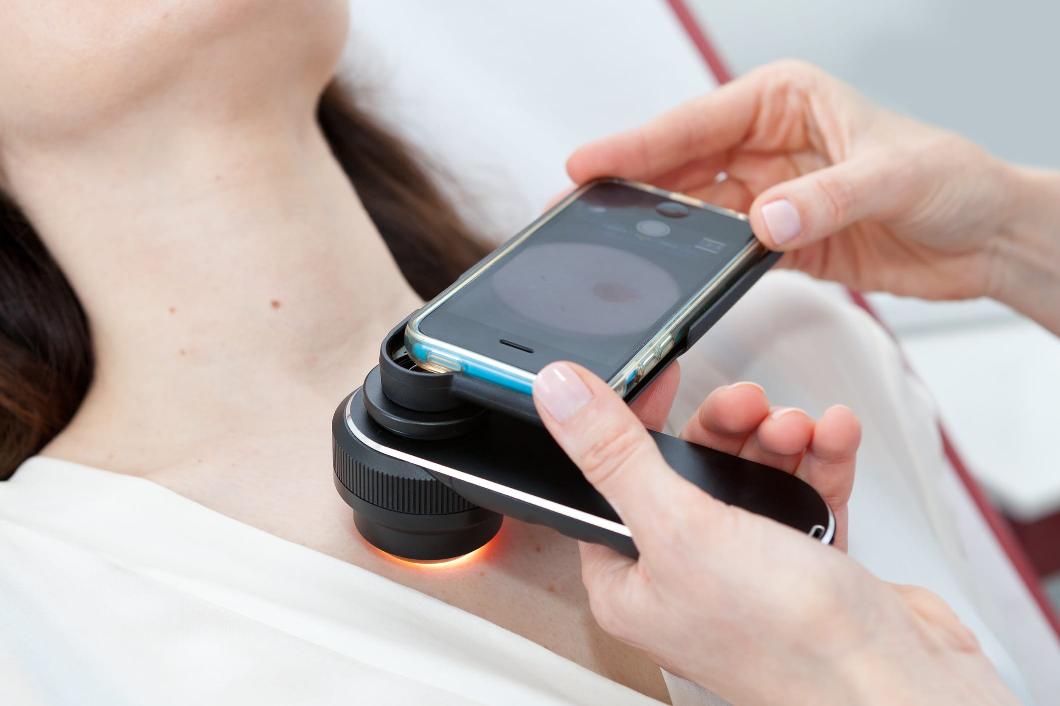 The Role of Mobile Dermatoscopes in Expanding Dermatological Care ...